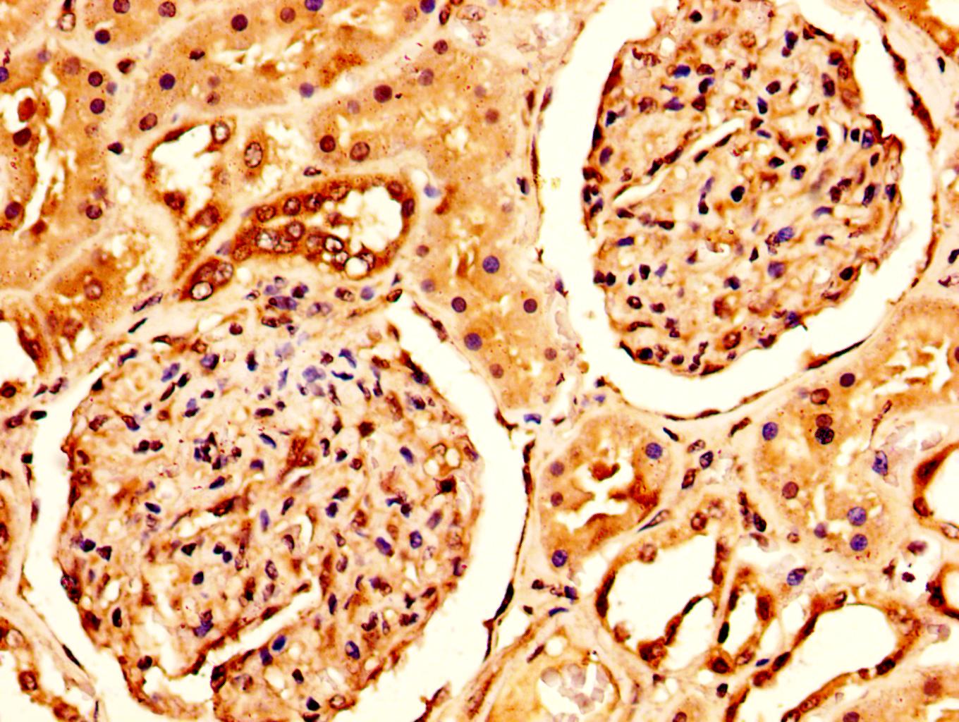CRYAB Antibody (PA5-97626)