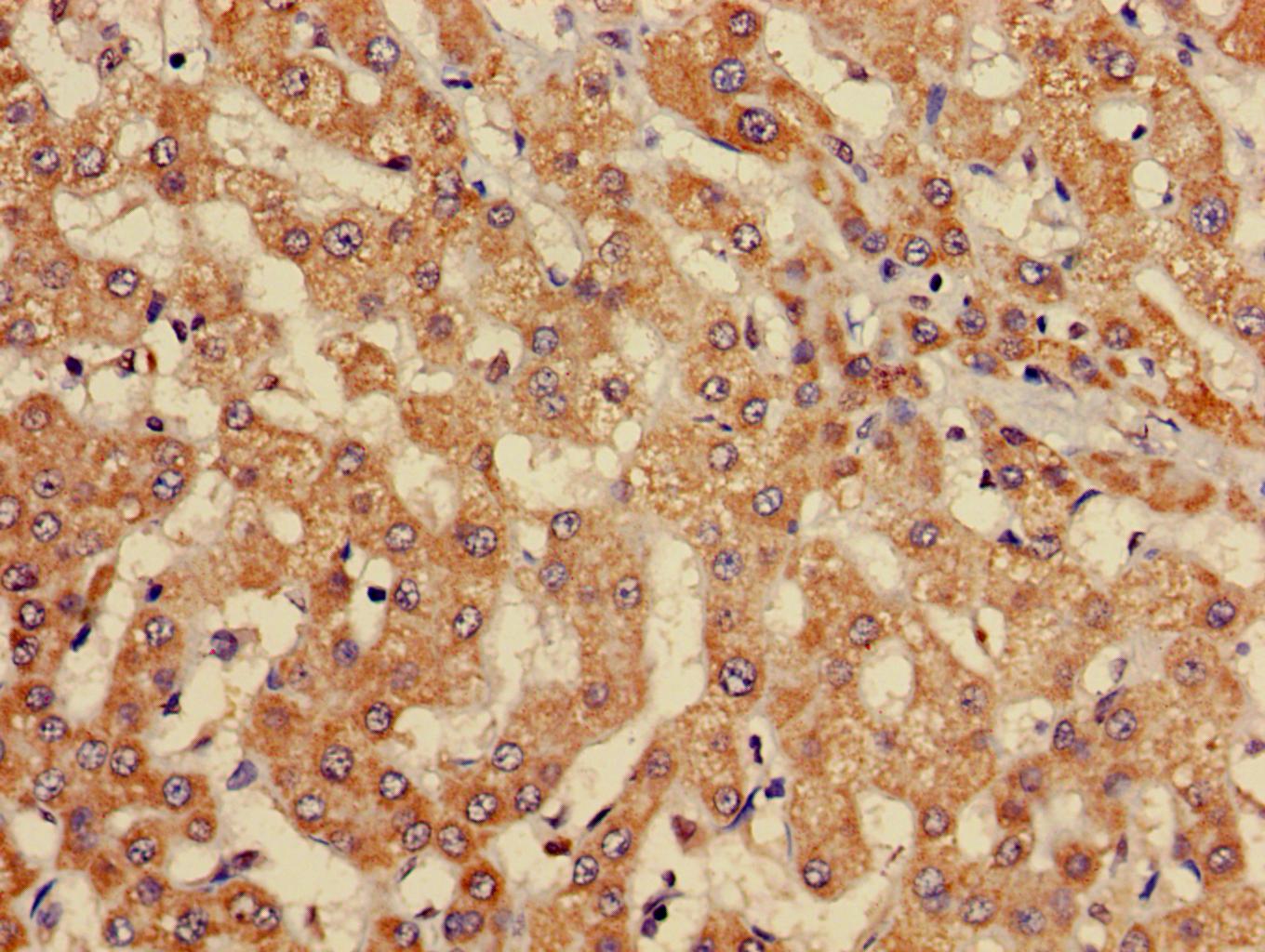EBI3 Antibody (PA5-97684)