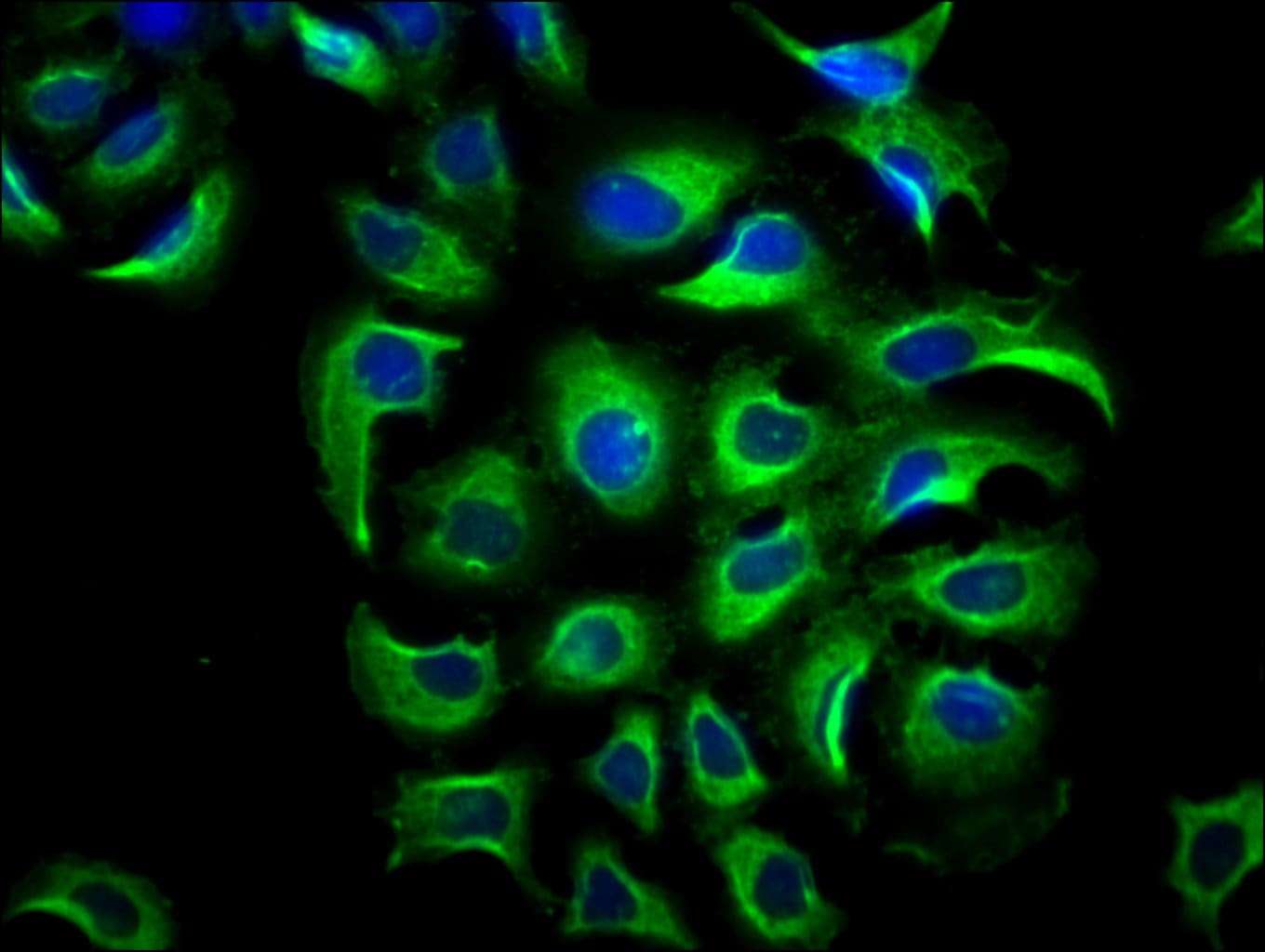 PP5 Antibody (PA5-98080)