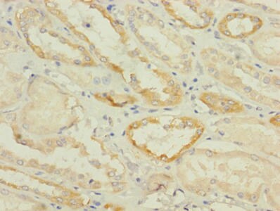 GPR91 Antibody (PA5-98179)