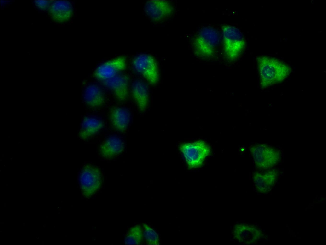 HLA-ABC Antibody (PA5-98325)