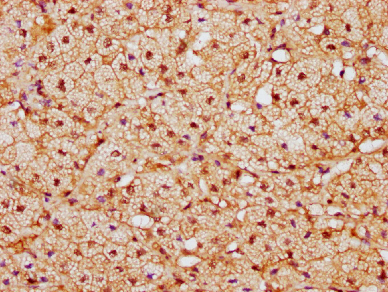 CAND1 Antibody (PA5-98580)