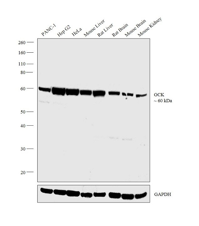 GCK Antibody (PA5-15072)
