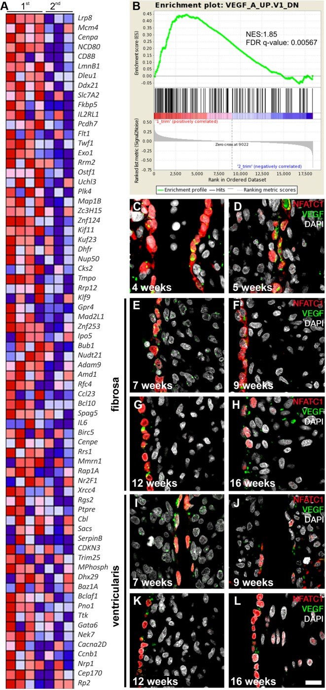 VEGF Antibody