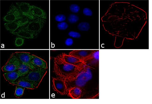 WT1 Antibody