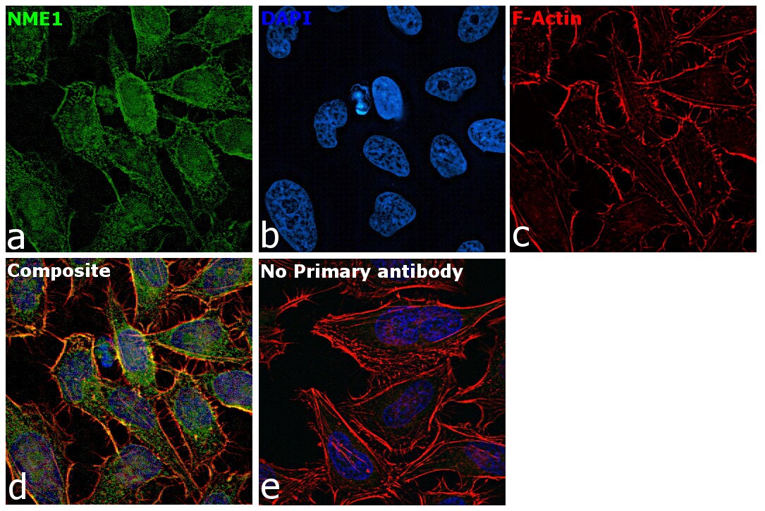 NME1 Antibody (PA5-17004)