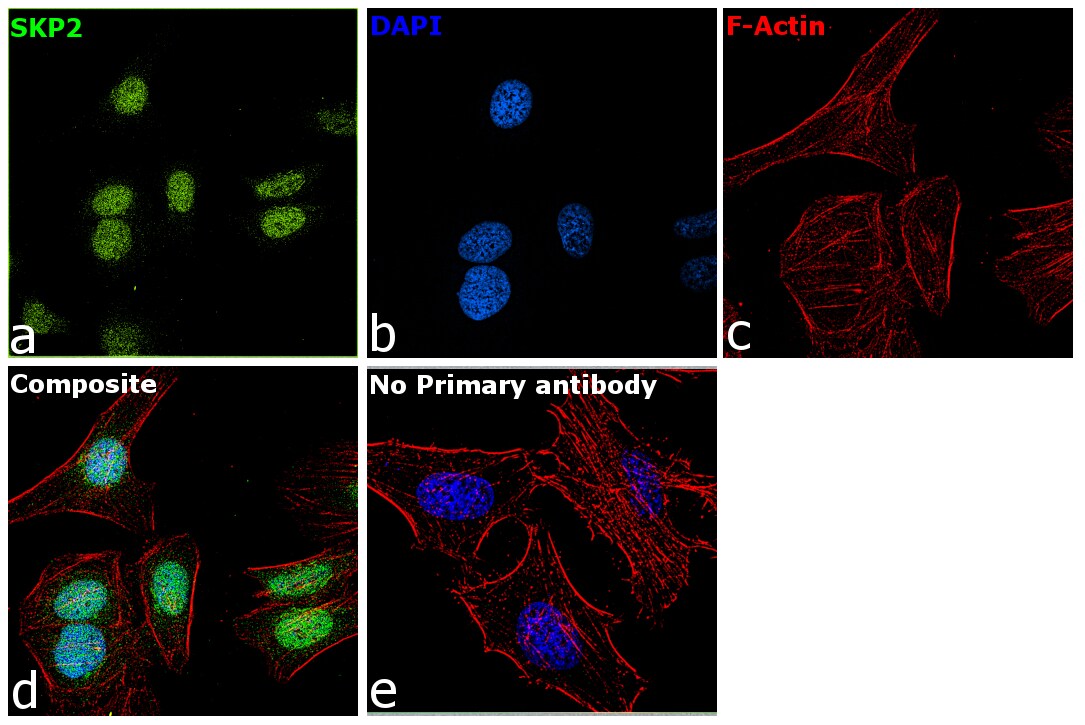 SKP2 Antibody (PA5-17009)