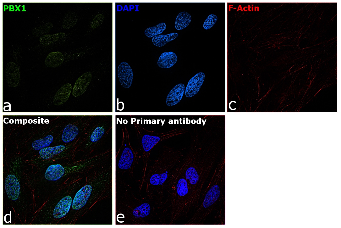 PBX1 Antibody (PA5-17223)