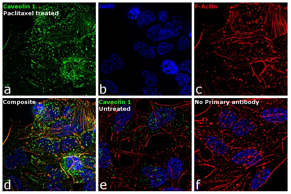 Caveolin 1 Antibody (PA5-17447)