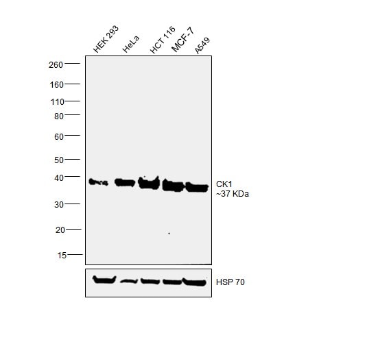 CK1 alpha Antibody (PA5-17536)