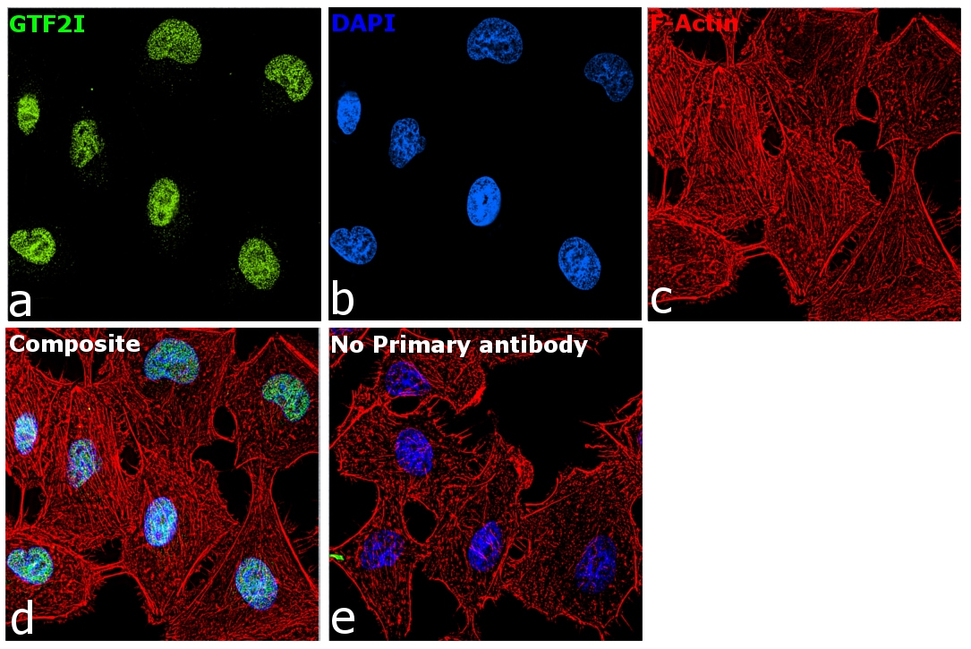 GTF2I Antibody (PA5-17642)