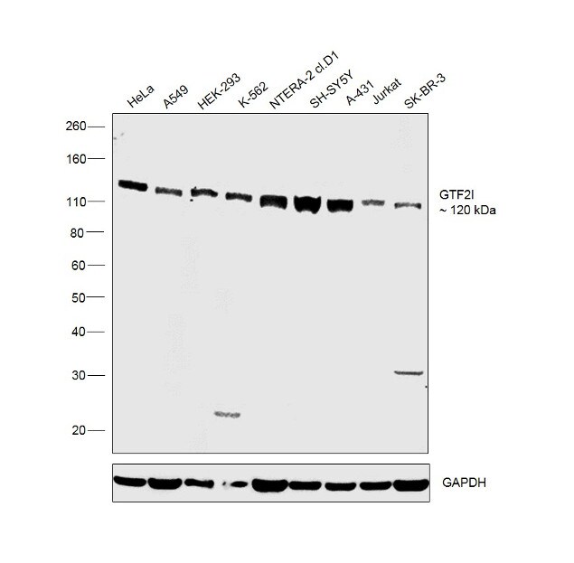 GTF2I Antibody (PA5-17642)