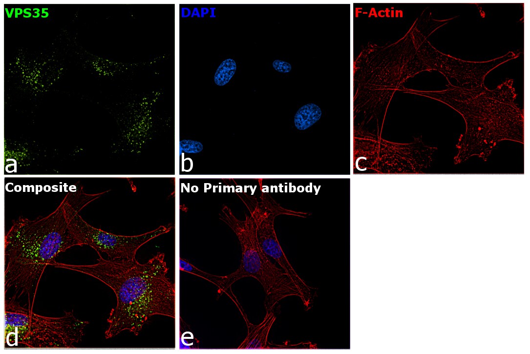 VPS35 Antibody (PA5-18248)