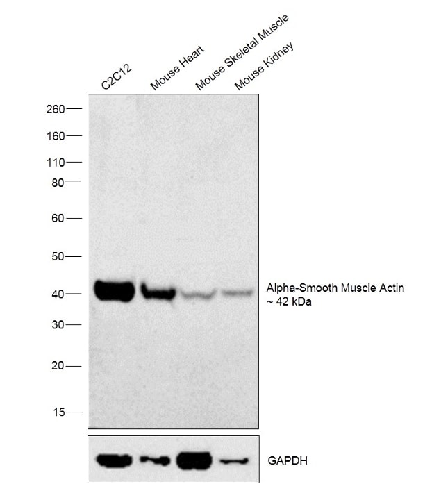 Alpha-Smooth Muscle Actin Antibody (PA5-18292)