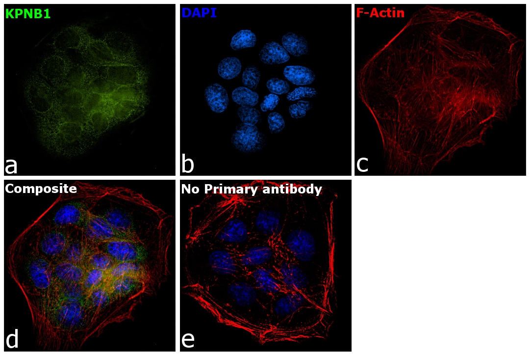 KPNB1 Antibody (PA5-18450)