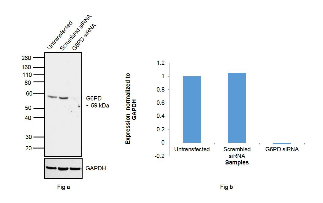 G6PD Antibody (PA5-18734)