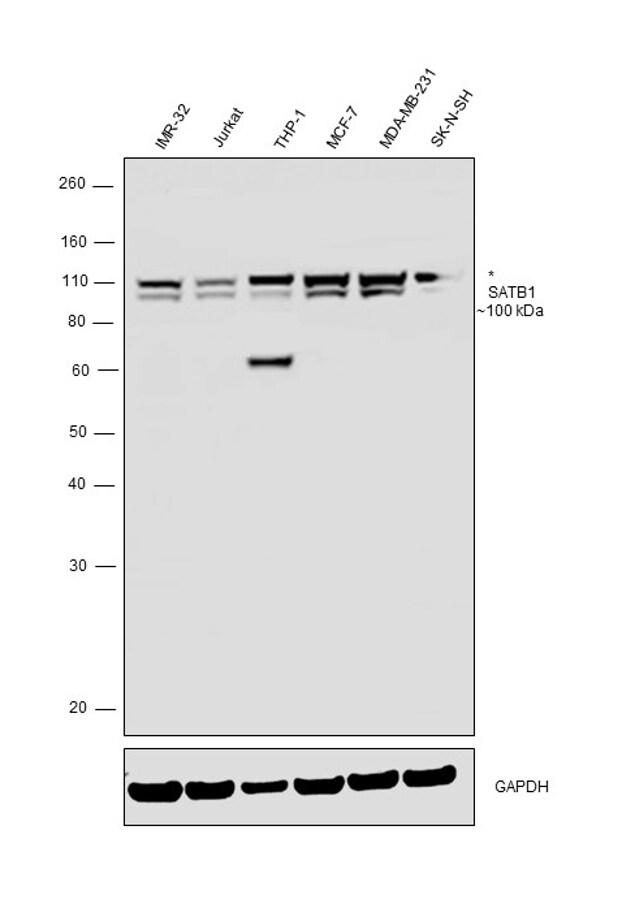 SATB1 Antibody (PA5-20535)
