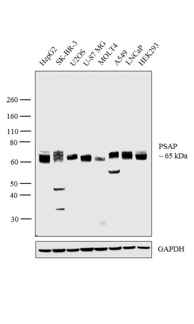 PSAP Antibody (PA5-21340)