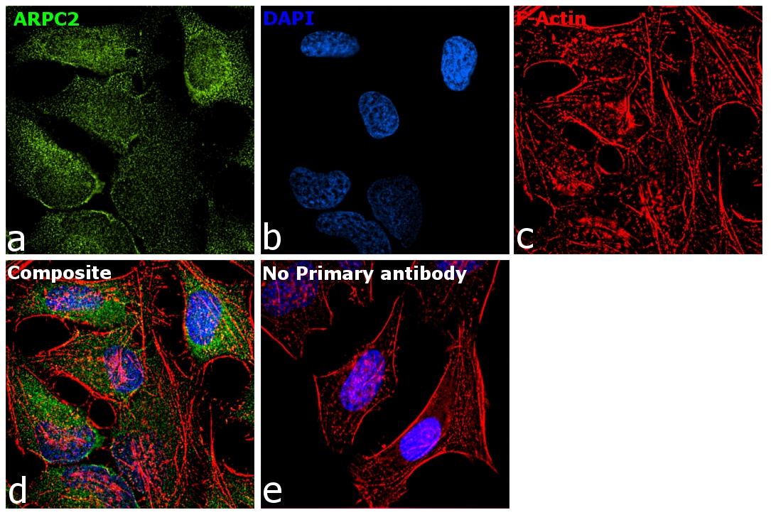 ARPC2 Antibody (PA5-21405)