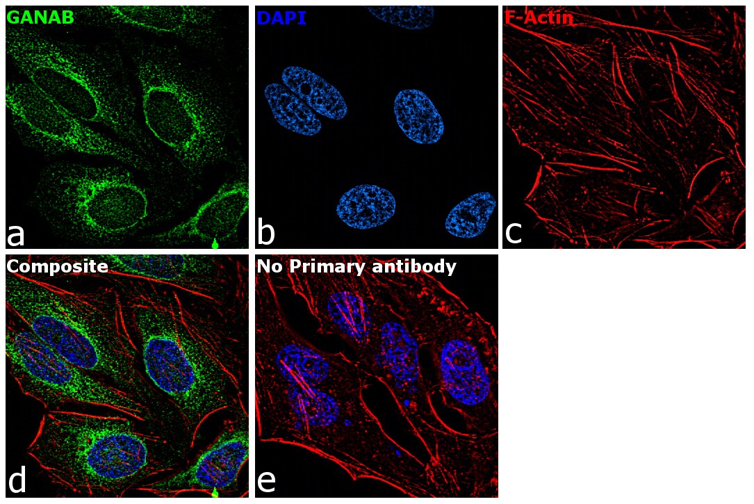 GANAB Antibody (PA5-21431)