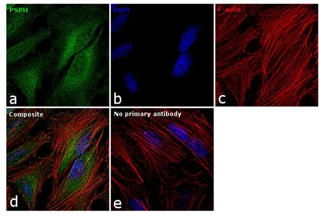 PSPH Antibody (PA5-22003)
