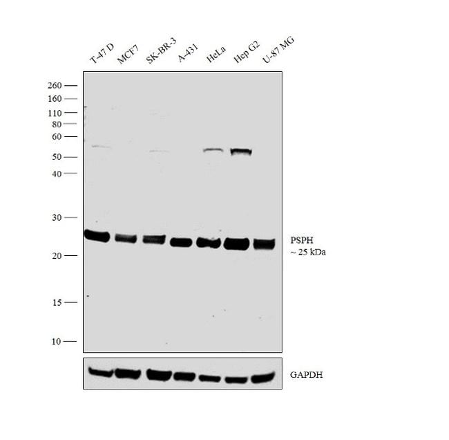 PSPH Antibody (PA5-22003)