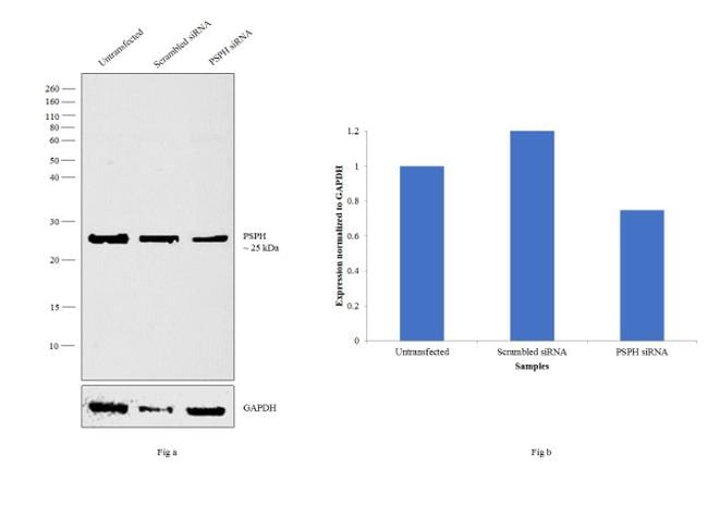 PSPH Antibody (PA5-22003)