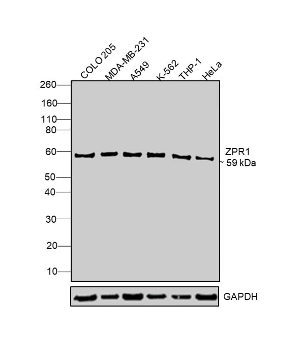 ZPR1 Antibody (PA5-22021)