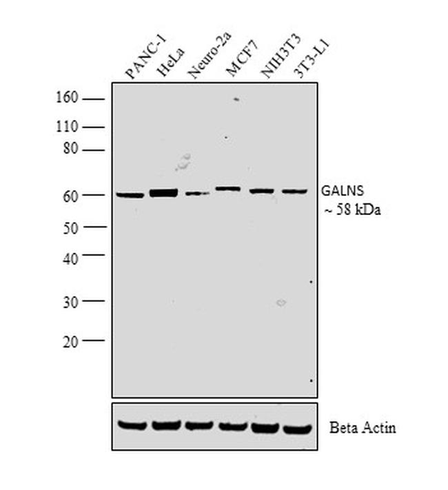 GALNS Antibody (PA5-22098)