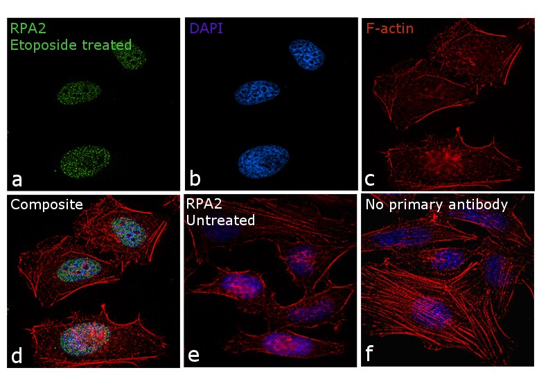 RPA2 Antibody (PA5-22256)