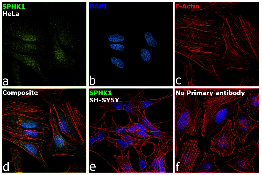 SPHK1 Antibody (PA5-22994)