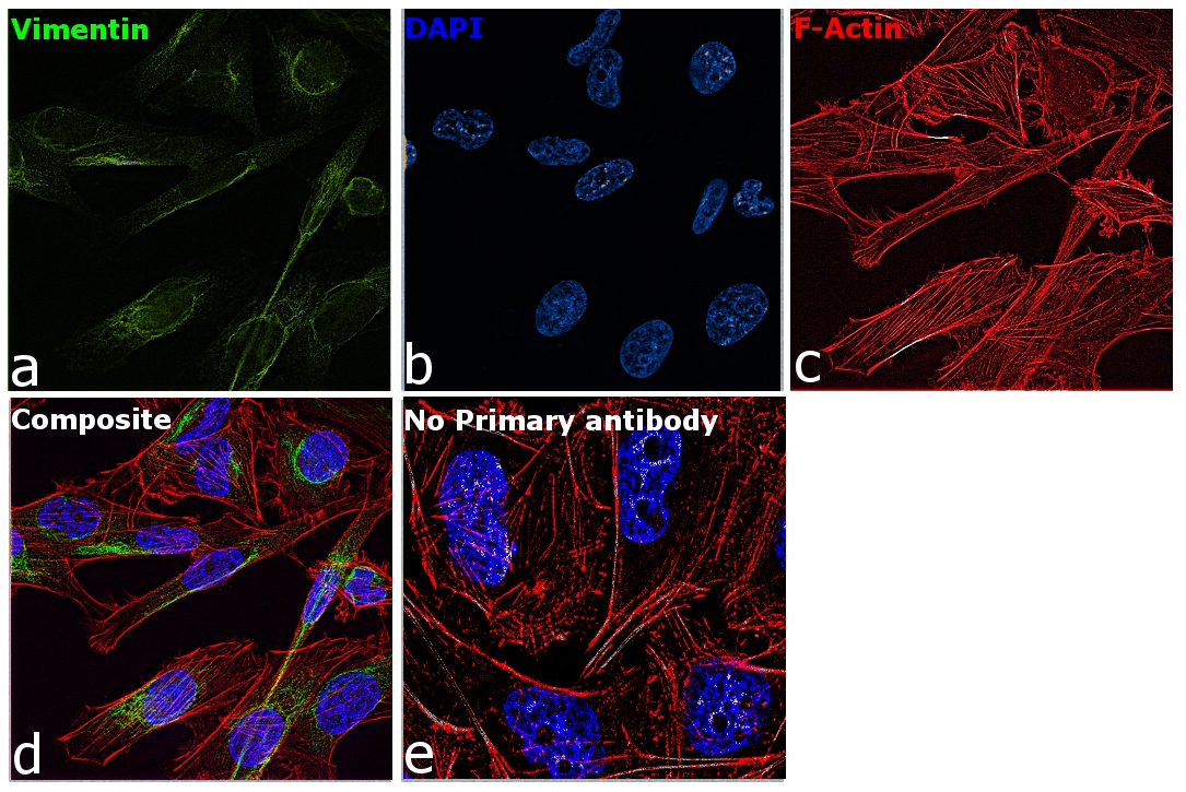 Vimentin Antibody (PA5-27231)