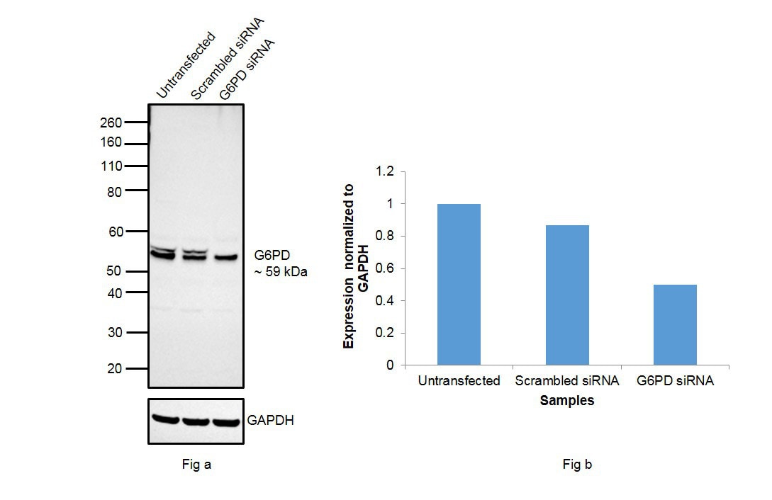 G6PD Antibody (PA5-27359)