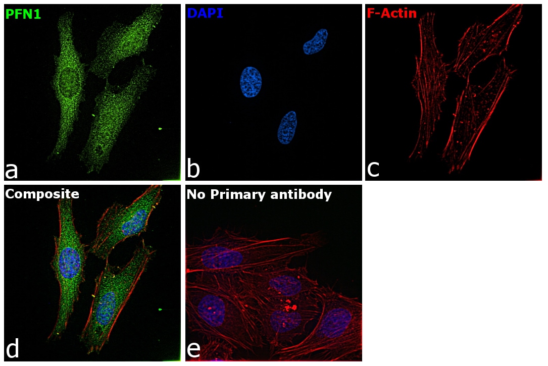 Profilin 1 Antibody (PA5-27612)