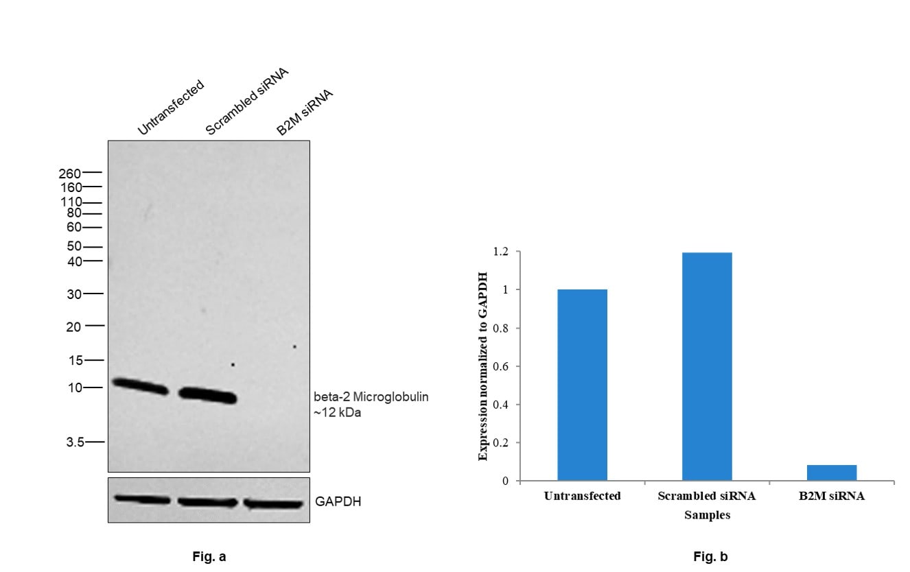 beta-2 Microglobulin Antibody (PA5-29580)
