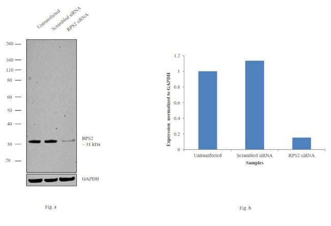 RPS2 Antibody (PA5-30160)
