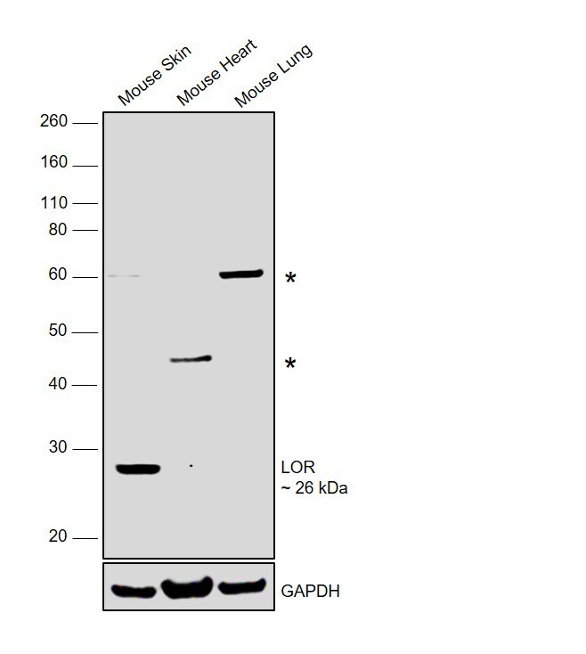 LOR Antibody (PA5-30583)