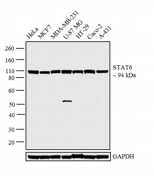 STAT6 Antibody (PA1-38675)