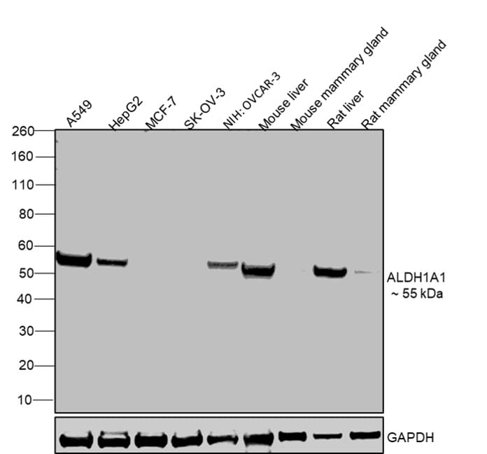 ALDH1A1 Antibody (PA5-34623)