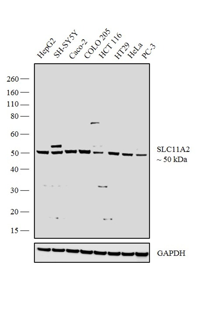 SLC11A2 Antibody (PA5-35136)