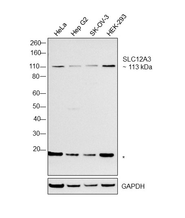 SLC12A3 Antibody (PA5-42408)