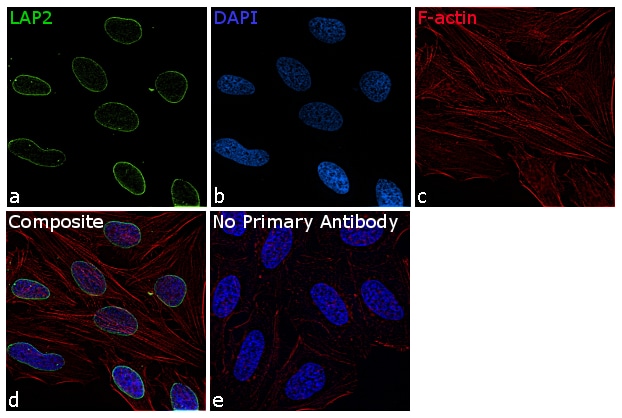 LAP2 Antibody (PA5-52519)