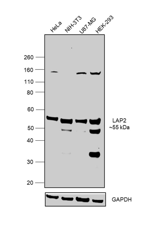 LAP2 Antibody (PA5-52519)