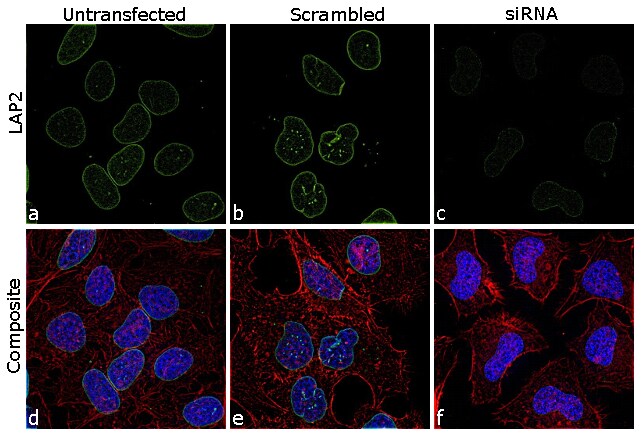 LAP2 Antibody (PA5-52519)