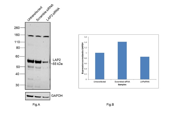 LAP2 Antibody (PA5-52519)
