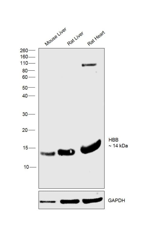 HBB Antibody (PA5-60287)