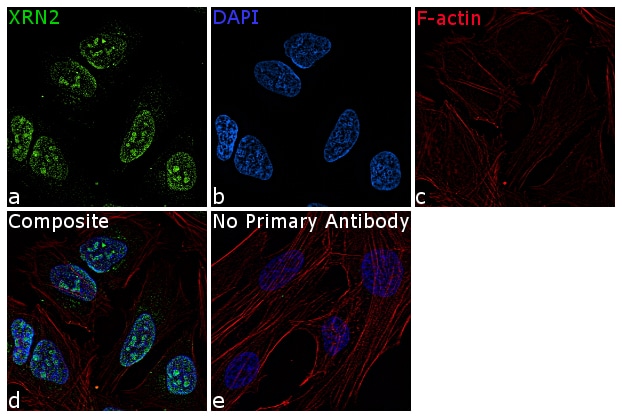 XRN2 Antibody (PA5-61433)