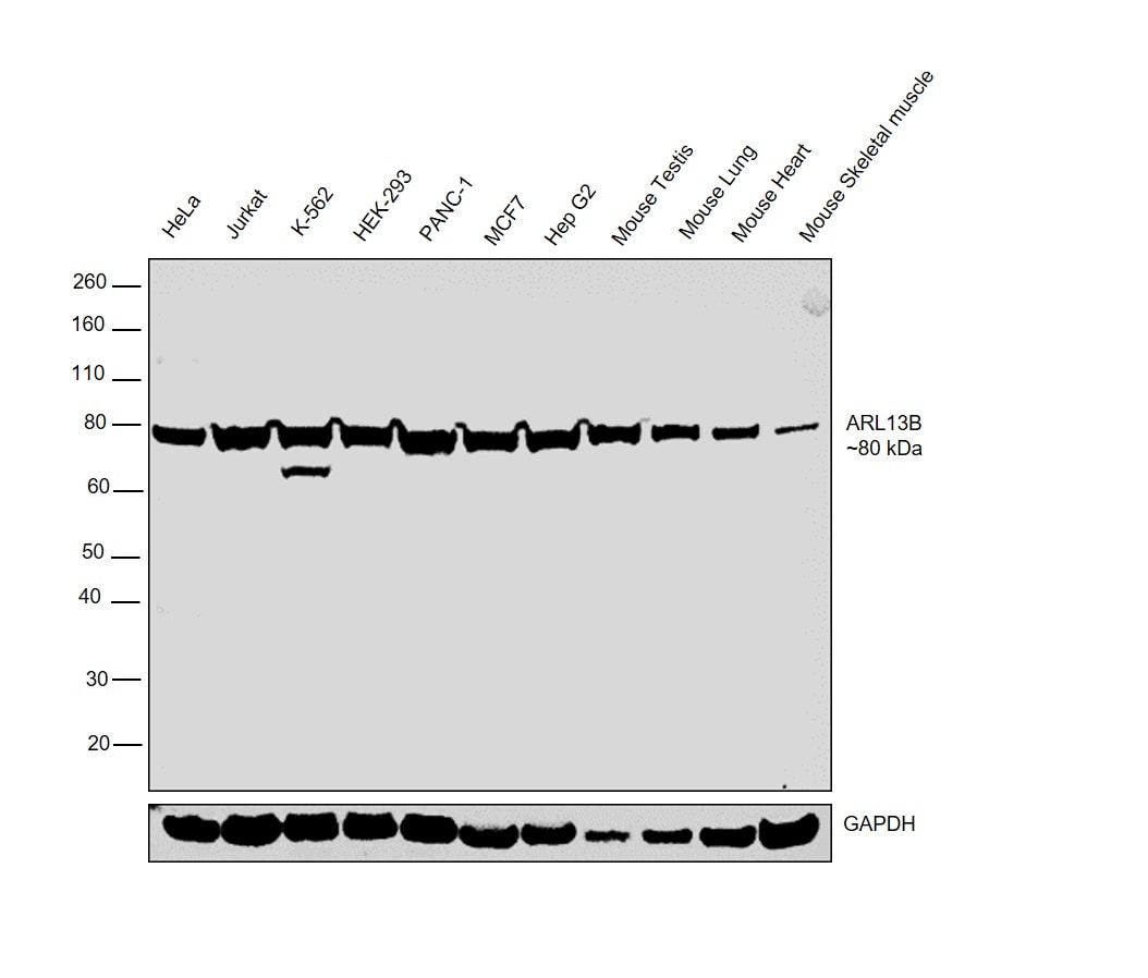 ARL13B Antibody (PA5-61840)