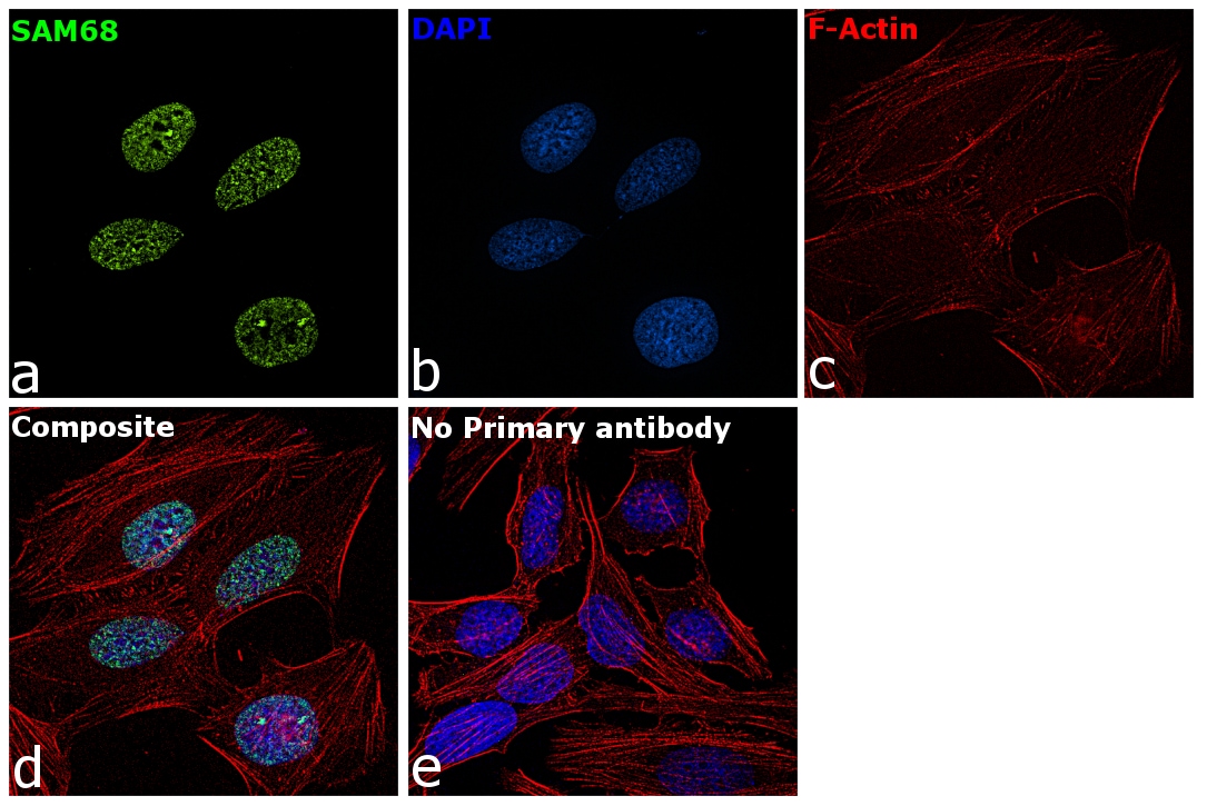 SAM68 Antibody (PA5-63349)
