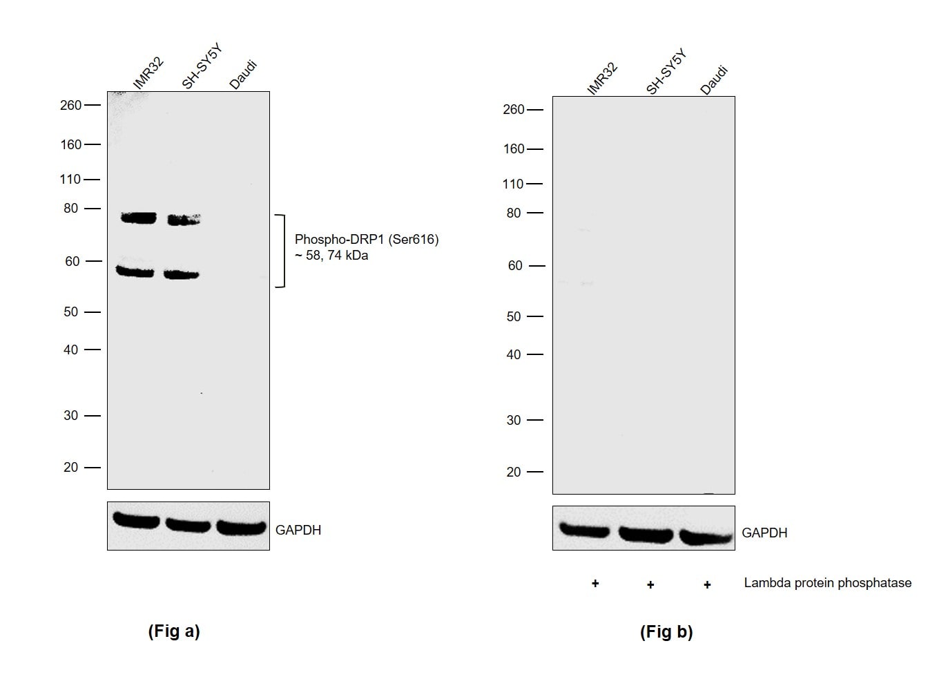 Phospho-DRP1 (Ser616) Antibody (PA5-64821)